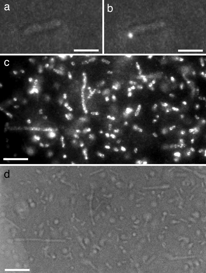 Phage microscopy: The Types, Techniques, and Importance