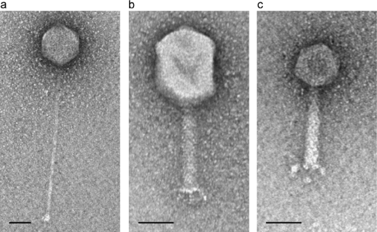 Phage microscopy: The Types, Techniques, and Importance