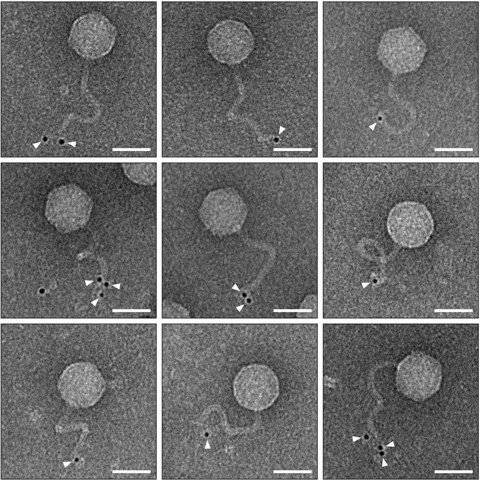 Sewage processing for bacteriophage isolation | The Phage