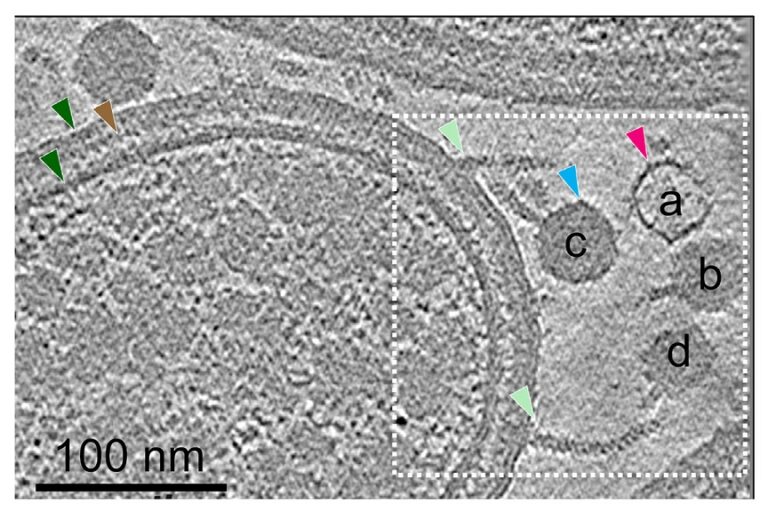 Cryo Electron Microscopy reveals visualisation of phages in detail ...